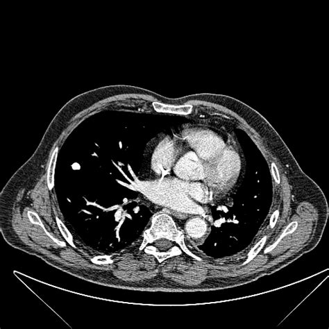 Medical Deepfake Image Datasett Object Detection Model By Medical