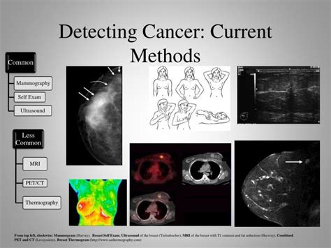 PPT Inexpensive And Accessible Thermal Imaging For The Detection Of