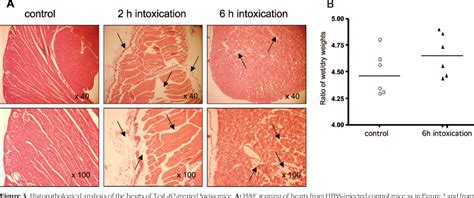 Figure 3 From Clostridium Sordellii Lethal Toxin Kills Mice By Inducing