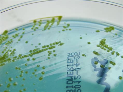 Sphingomonas Paucimobilis On C L E D Agar Detail Flickr