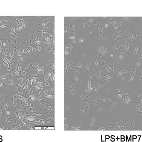 Effects Of Bmp7 On Lps Induced Hmc3 Microglial Polarization A B The