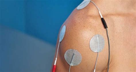 What Is Interferential Therapy