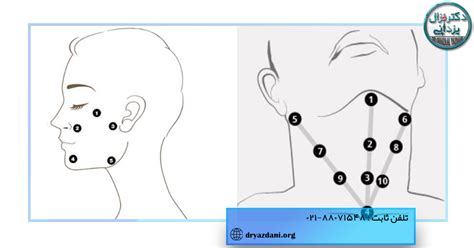 تزریق پروفایلو دکتر غزال یزدانی