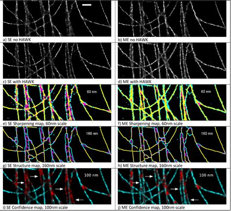 Open Access Sub Diffraction Error Mapping For Localization Microscopy