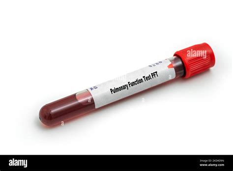 Pulmonary Function Test Conceptual Image Stock Photo Alamy