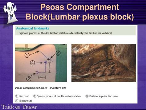 Ppt Lower Extremity Peripheral Nerve Block R4 장 지 혜 Powerpoint