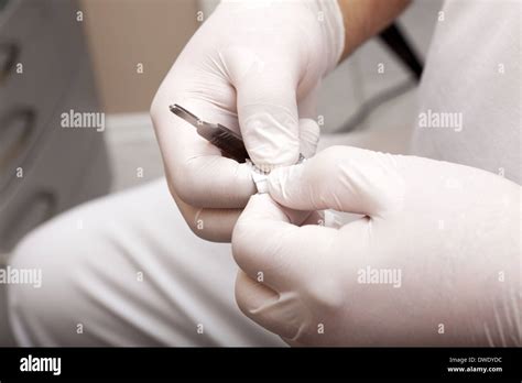 Scalpel Blade Hi Res Stock Photography And Images Alamy