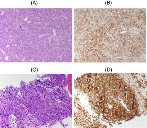 Selected Images From The Pathological Evaluation A The Download Scientific Diagram