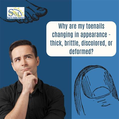 Thick Brittle Discolored Or Deformed Toenails