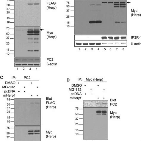 A Model For Polycystin 2 Pc2 Degradation Through The Endoplasmic