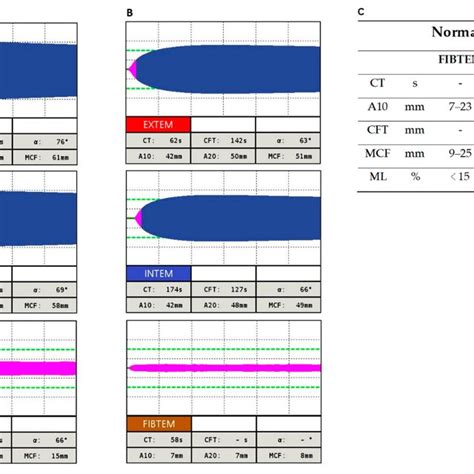 Rotational Thromboelastometry Extem Extrinsically Activated