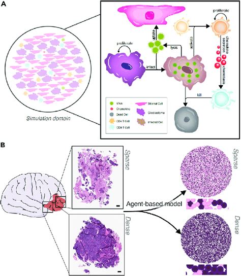 Agent Based Model Of Glioblastoma Patient Tumor Tissue Slices Infected