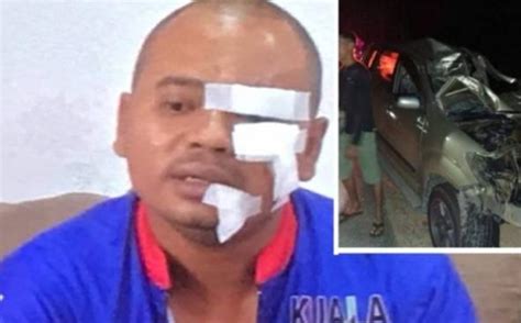 “selepas Kemalangan Gajah Patah Balik Pijak Kereta” Mangsa Gempak