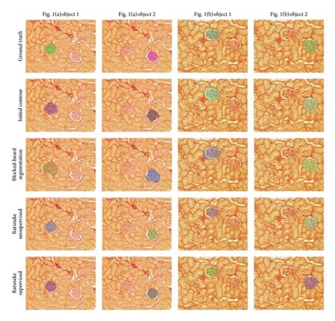 Representative Segmentation Results Obtained Using Different Methods