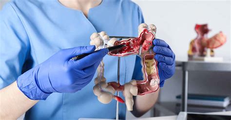 Darmkrebs Symptome Diagnose Therapie Dkv