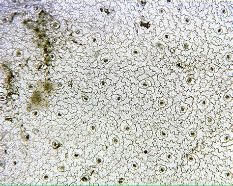 Plante Epidermis Mikroskop