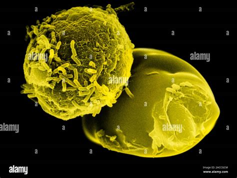 Scanning Electron Micrograph Sem Tinted Green Of The Bacteria