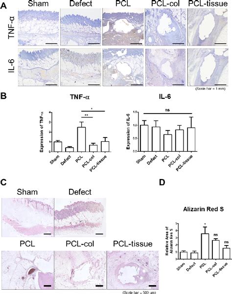 Pdf Breast Tissue Restoration After The Partial Mastectomy Using