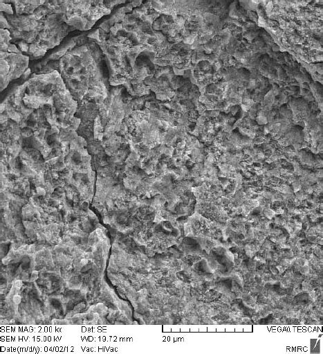 Enamel Surface After Conventional Acid Etching Note The Cracks On