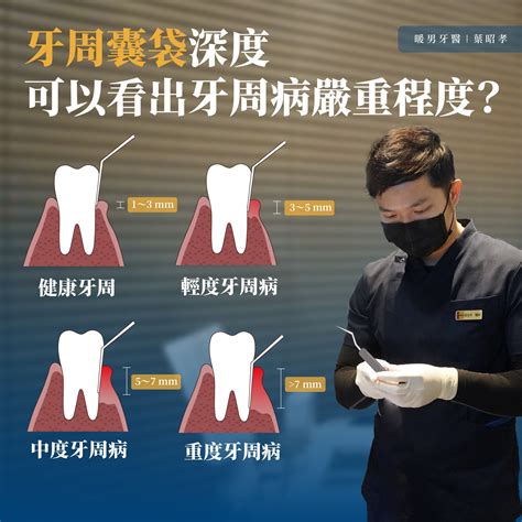 🙋‍♂️「醫師！我要怎麼知道牙周病的嚴重程度啊 」 ⠀⠀ 醫人也醫心，看牙超暖心 － 暖男牙醫葉昭孝