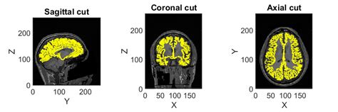 meg source imaging and group analysis