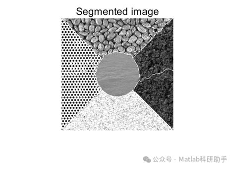 【图像处理】基于小波编码图像中伪影和纹理的检测附matlab代码小波增强伪影 Csdn博客