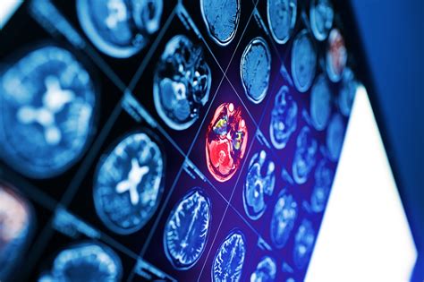 How An Efficient Dicom Router Elevates Healthcare Workflow
