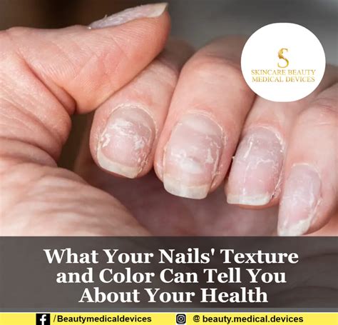 What Your Nails Texture And Color Can Tell You About Your Health