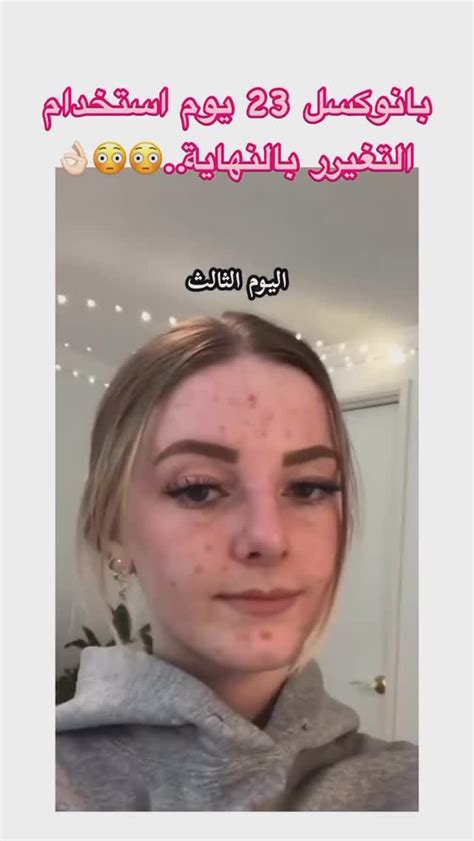 ‎اورنج بيوتي‎ ‎هم جربتي غسول بانوكسيل للحبوب لو بعدج؟؟‎ Instagram