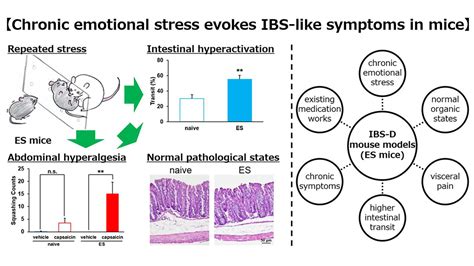 Repeated Psychological Stress Is Linked With Irritable Bowel Syndrome