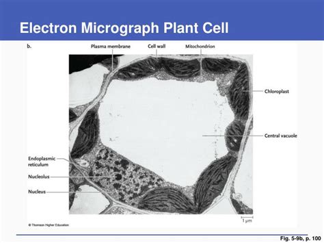 Plant Cell Micrograph Labelled At Harold Walters Blog