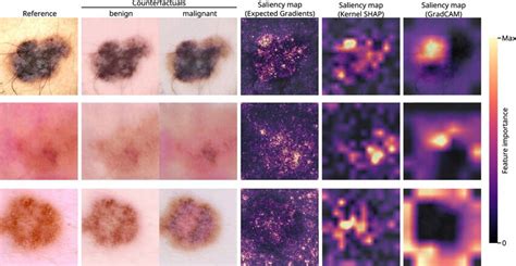 Comparison Of Insights From Counterfactuals And Saliency Maps We