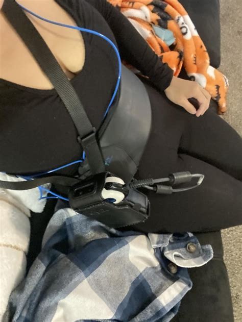 Gi Bleeding R Crohnsdisease