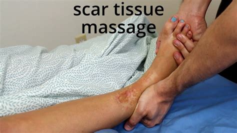 Massage Tutorial Mature Scar Tissue Myofascial Release Youtube
