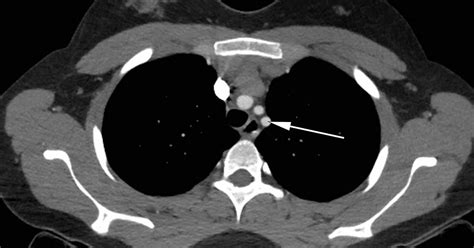 Radiology Cafe