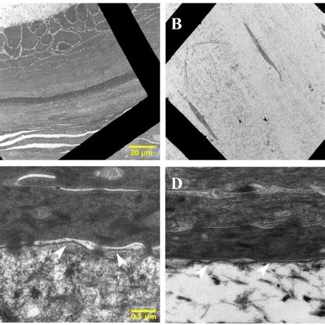 Transmission Electron Microscopy Tem Showing Epithelial Bm Assembly
