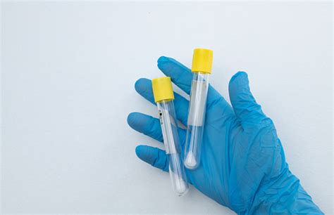 실험실용 파란색 장갑에 구연산나트륨을 장착한 혈액 샘플과 수집을 위한 두 개의 진공관 흰색 배경에 0명에 대한 스톡 사진 및