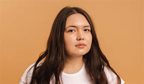 Pcos Acne Causes Treatment And Prevention