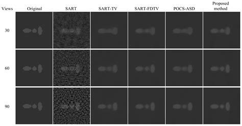 Micromachines Free Full Text Reconstruction Of Sparse View X Ray