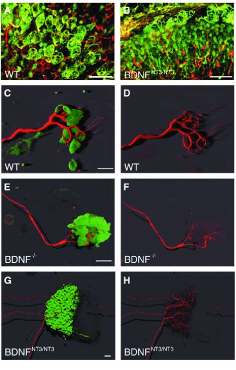 Bdnftrkb Signalling Is Required For Terminal Innervation And Formation