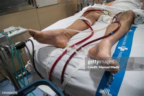 Ecmo Photos And Premium High Res Pictures Getty Images