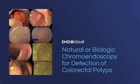 Natural Or Biologic Chromoendoscopy For Detection Of Colorectal Polyps