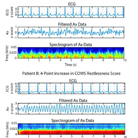 Spectral Analysis Of Accelerometer Waveforms Extracted From 10−s Download Scientific Diagram