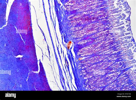 Fundic Region Stomach Cross Section Showing Mucosa Submucosa