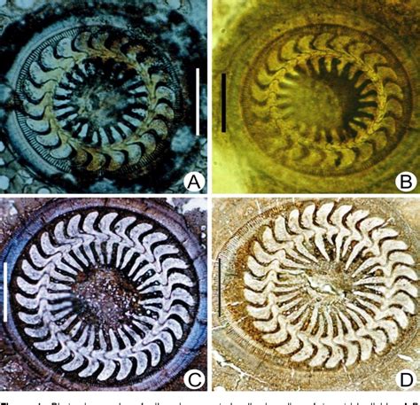 Figure 2 From Study Of Trichodinids Protozoa Ciliophora Parasitic On