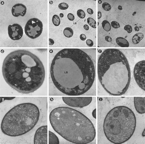 Detection Of Lipid Droplets Of R Glacialis R15 R Glutinis R4 And R
