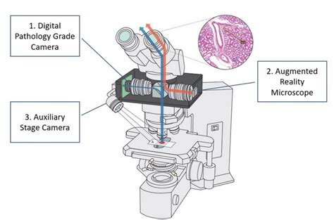 Microscope Based Digital Pathology System Augmentiqs