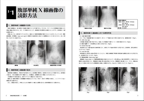 診療放射線技師 読影ノート 腹部編