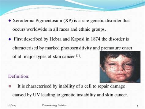 Xeroderma Pigmentosum Chromosomes Xeroderma Pigmentosum جفاف