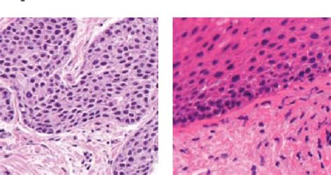 Figure 2 From A Robust Method For Nuclei Segmentation Of Hande Stained